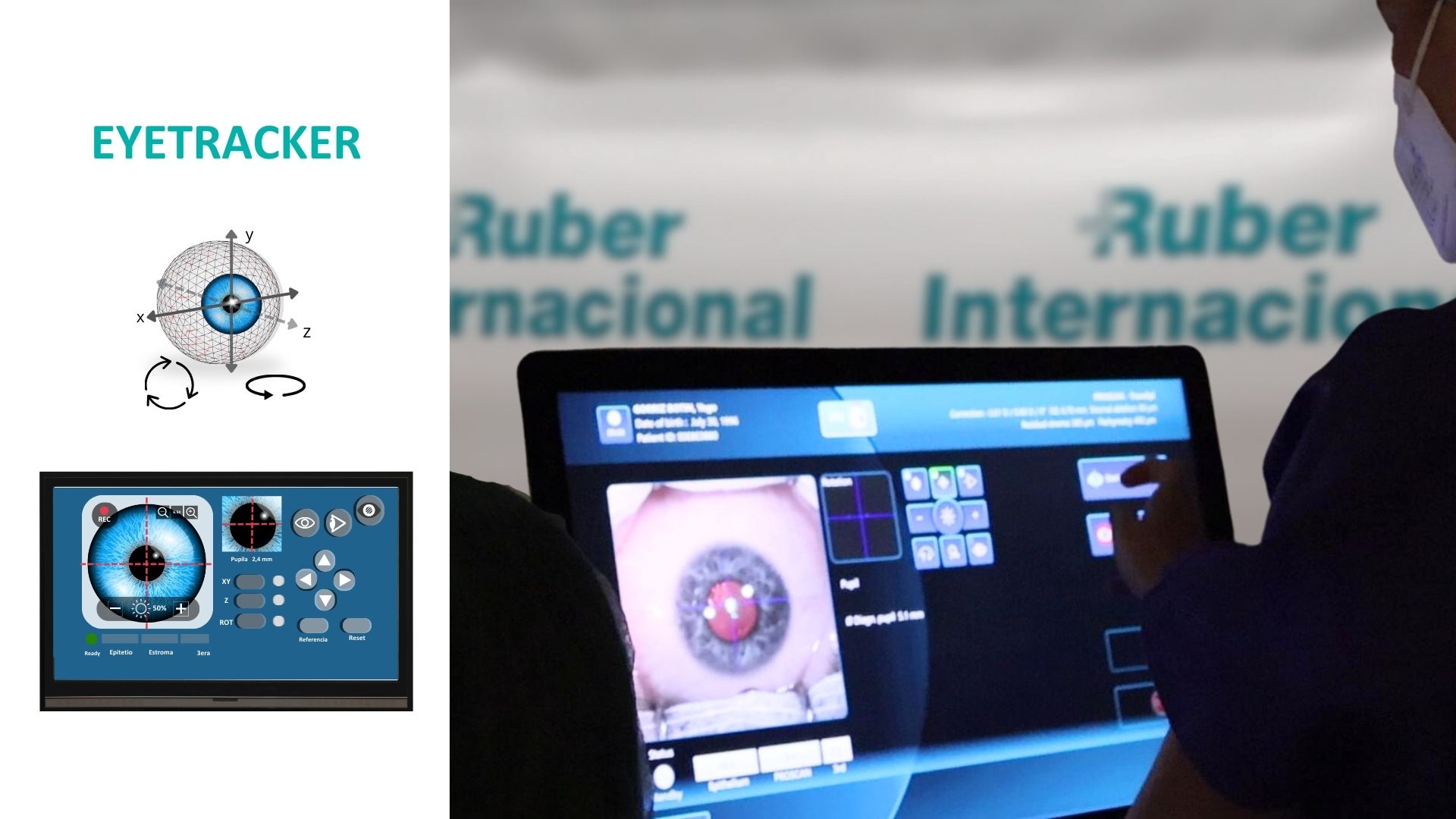 Cirugía refractiva láser PRK segura con EyeTracker: Tecnología de precisión ocular